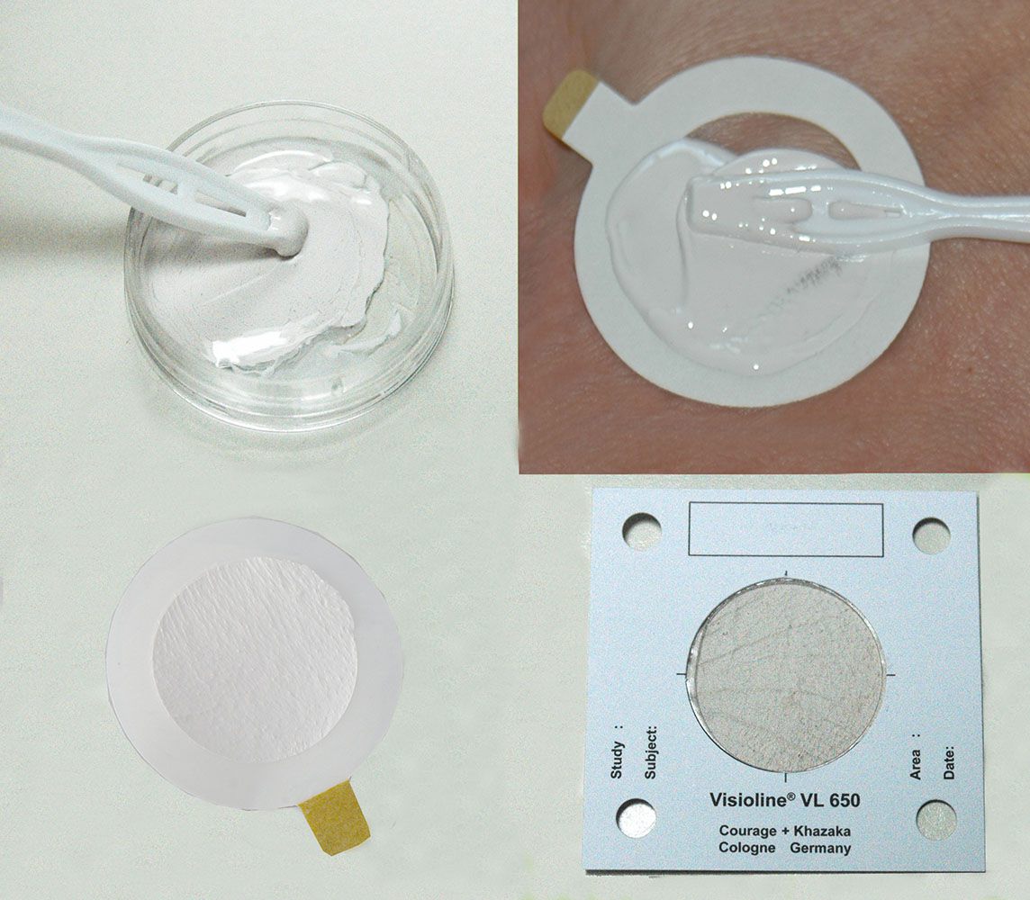 Visioline®/Quantirides® - Assessment of deep facial lines