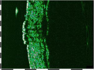 Flexible skin measurement tools for all applications