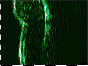 Measurements around the nails