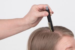 Measurements on Hair and Scalp